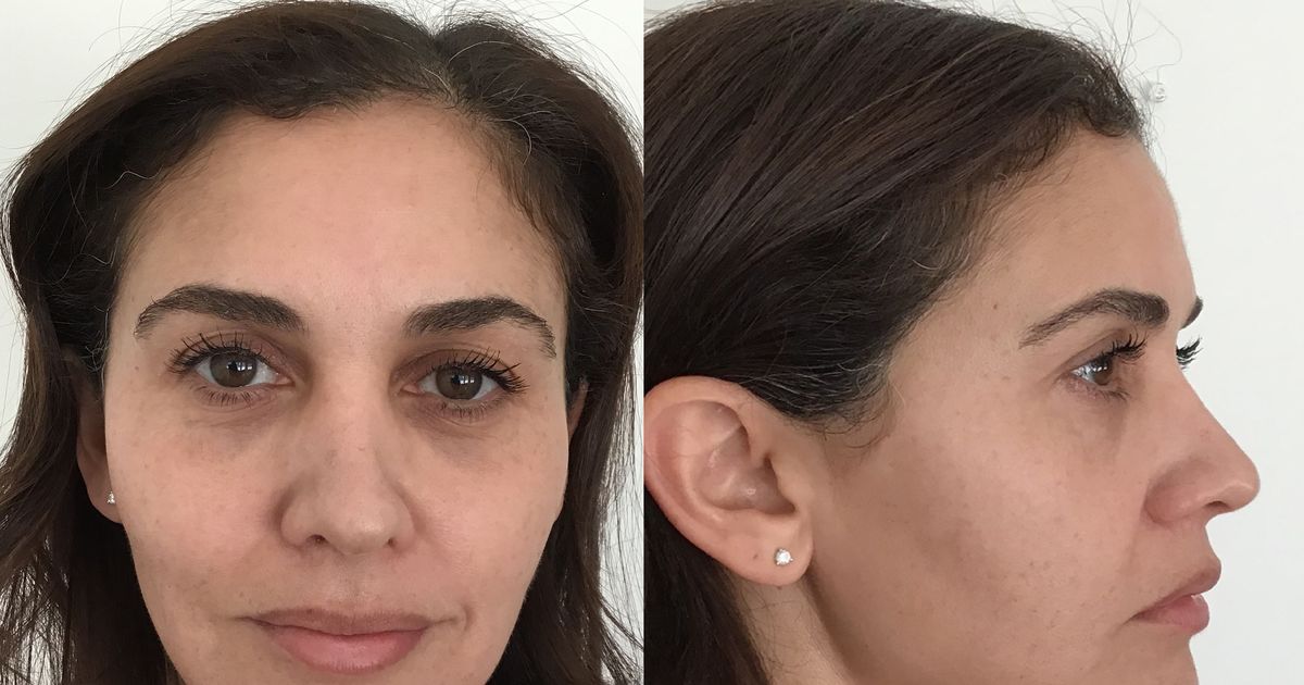 How to Look Younger — No Cutting Required! | ExtraTV.com