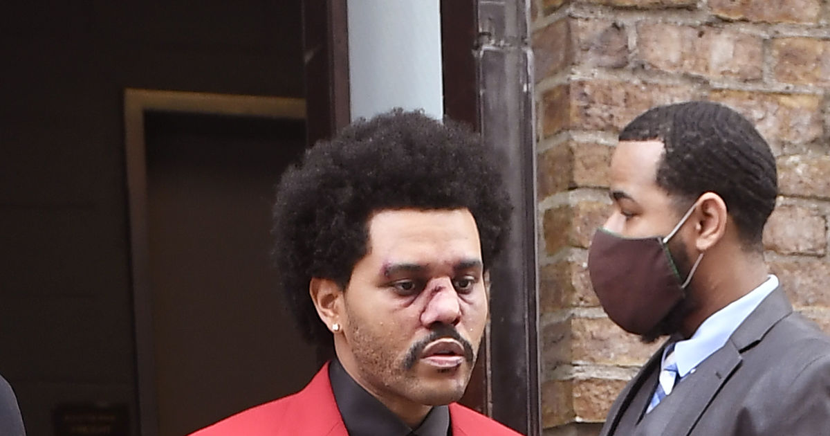 Blinding Lights | ExtraTV.com